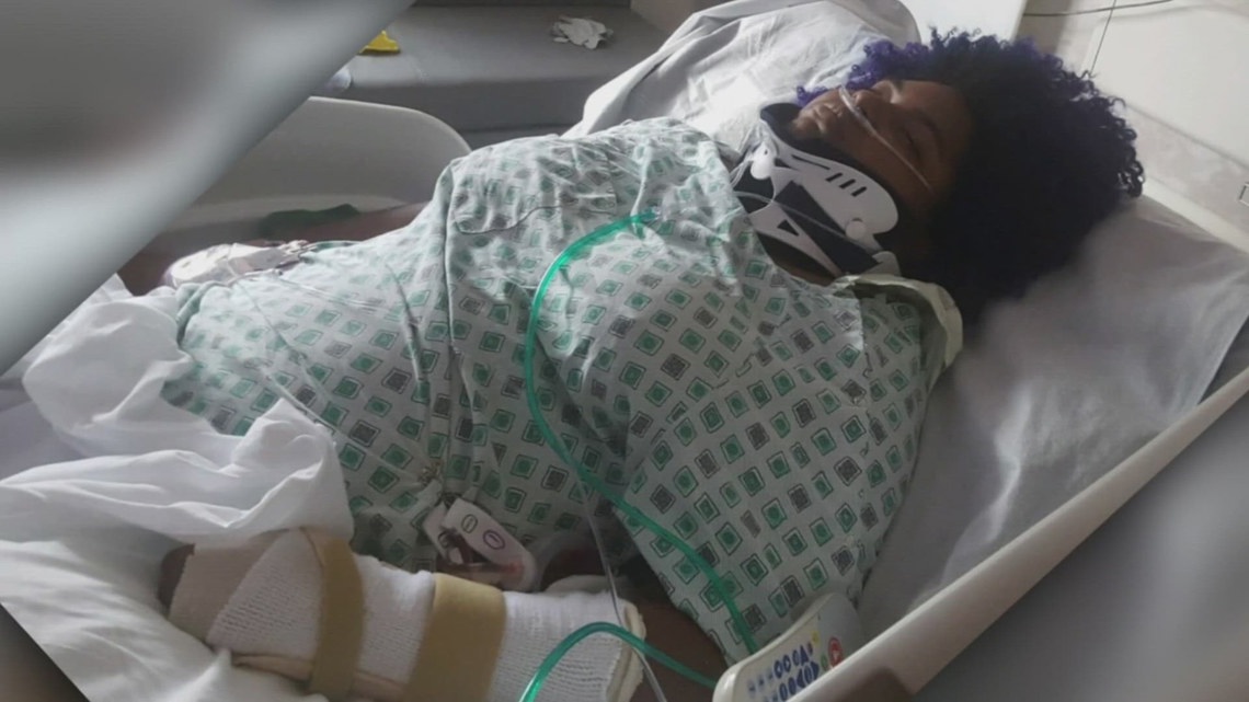 Court awards $20 million for Fire Ball ride survivor | wtol.com