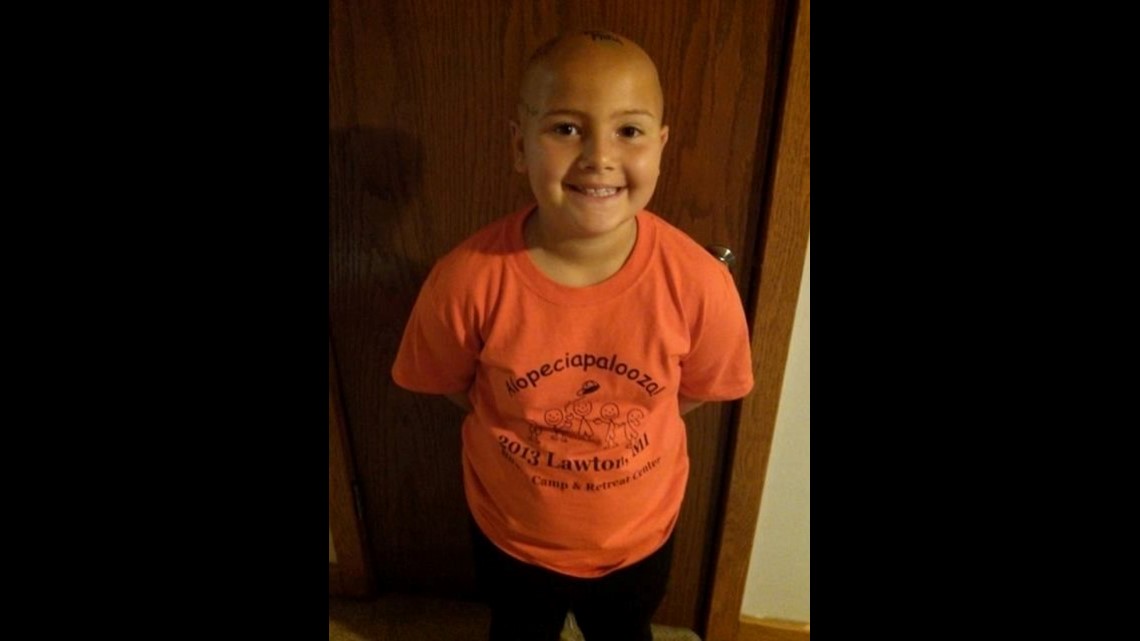 8-year-old decorates bald head to protest bullying | wtol.com