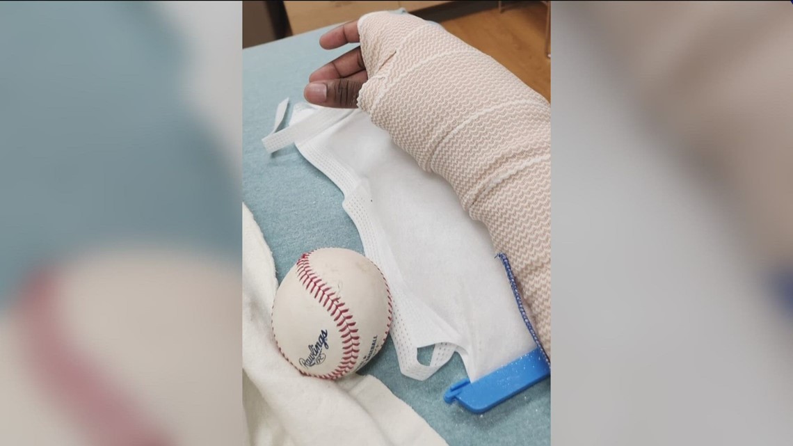 Dad catches foul ball at baseball game... breaks his hand in the ...