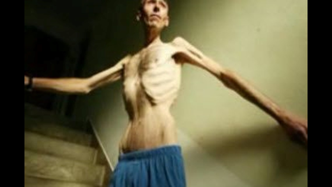 WTOL 11 Special Report: Local woman's silent fight with eating ...