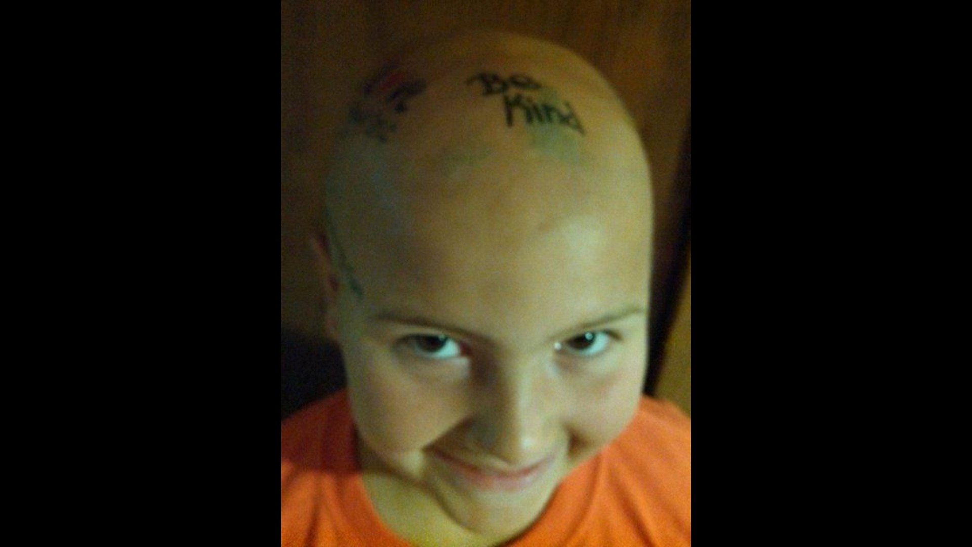 8-year-old decorates bald head to protest bullying | wtol.com