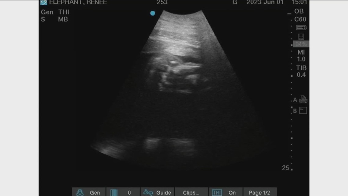 Toledo Zoo releases ultrasound photo of elephant calf due in spring ...
