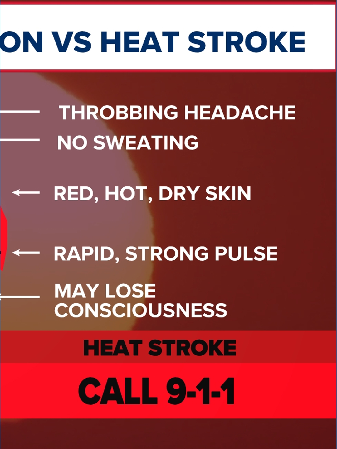 What's the difference between a heat watch, heat advisory and heat ...
