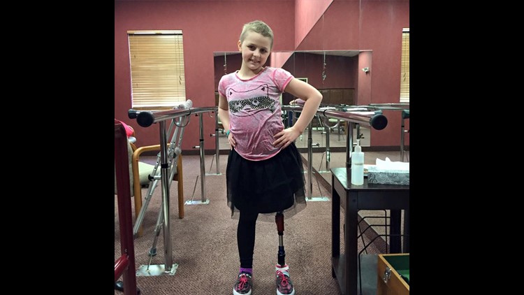 Miracle Kids: Cancer survivor dances on after leg amputation | wtol.com