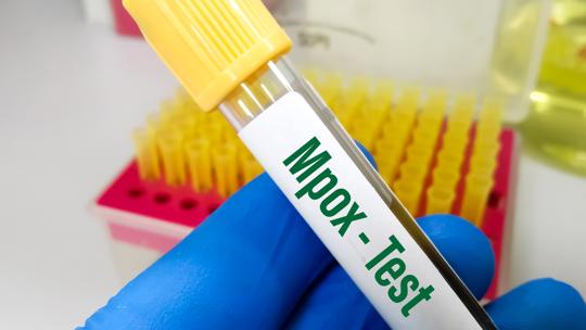 Federal researchers charged with smuggling mpox virus samples through ...